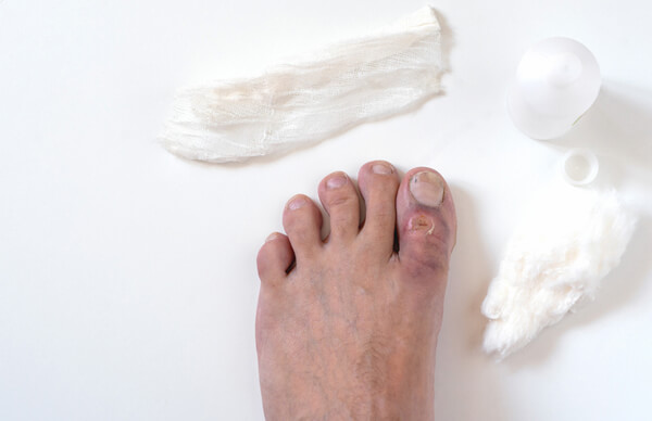Feeling Cold and Itchy? Watch Out for Cold-Related Illnesses This Winter