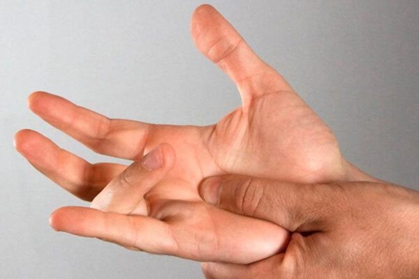 Swollen Fingers: 10 Signs It's More Than Just a Temporary Bump
