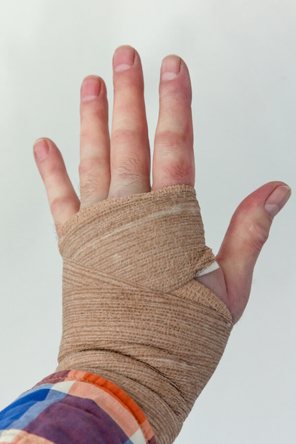 Swollen Fingers: 10 Signs It's More Than Just a Temporary Bump