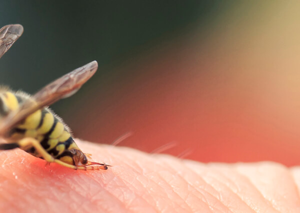 Why 80% of Bee Sting Accidents Happen During This Time of Year